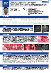 ORBEYEによるHeads Up Surgery Parasagittal meningiomaにおける侵襲性低減の試み|動画・レポート ...